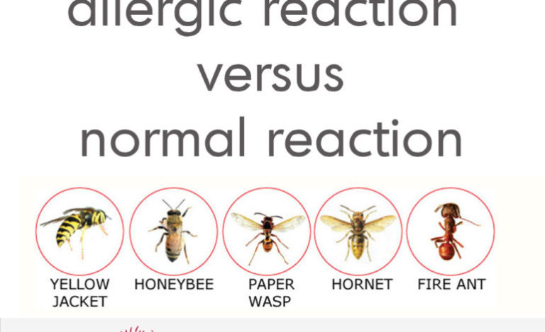 Insect Stings: Allergic Reaction and Normal Reaction - Family Allergy ...